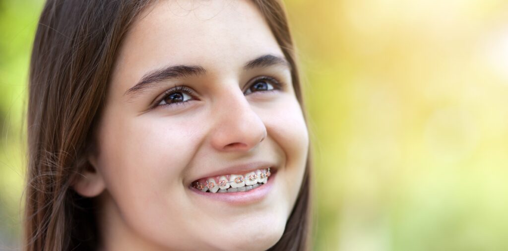Do Braces Change Your Face Shape? The Science Explained